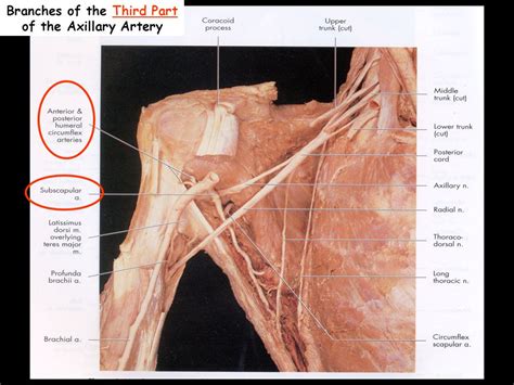 Subscapular Artery Cadaver