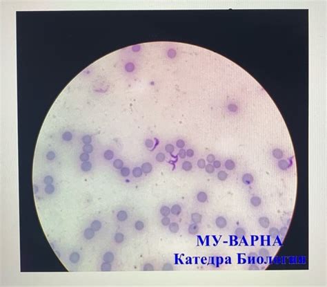 Parasitology Practical Exam Flashcards Quizlet