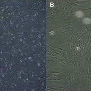 Morphology Of Adipose Tissue Derived Mesenchymal Stem Cells AD MSCs