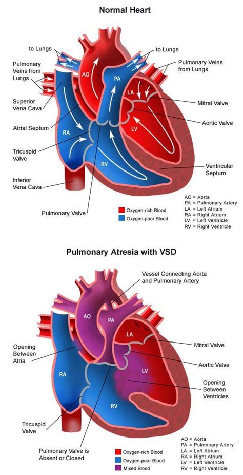 Heart Anatomy Concise Medical Knowledge Pediatric Heart Medical
