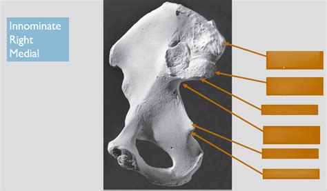Os Coxa Bony Features Medial Diagram Quizlet