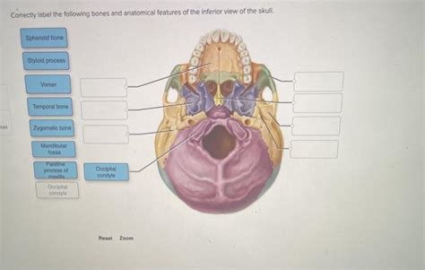 Solved Correctly Label The Following Bones And Anatomical Chegg