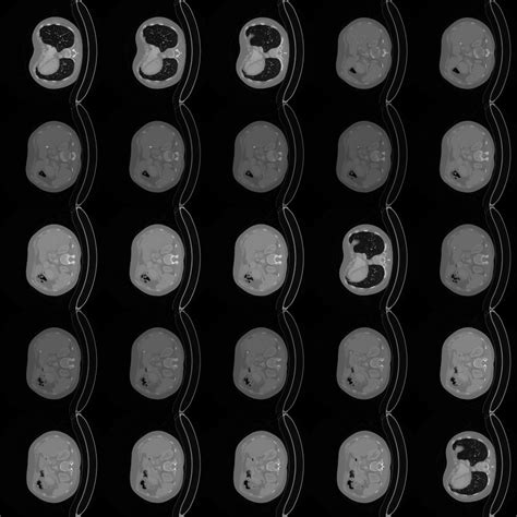 Read 3D NIFTI Images In Python3 Idiot Developer