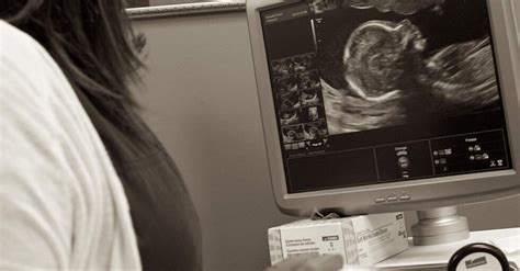 Ultrasound AFA OB GYN