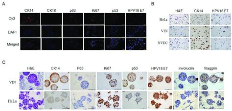 Expression Of Cell Type Specific And Viral Markers In VIN Cells A
