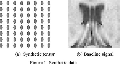 figure 1 from a new dti image denoising method based on shearlet shrinkage and complex diffusion