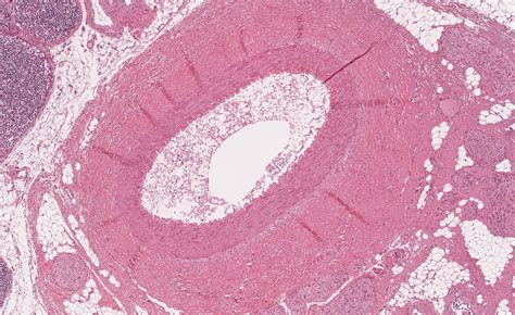 Cardiovascular System Histology