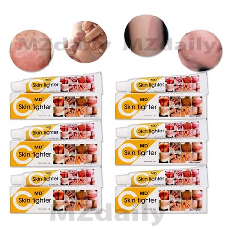 SET 6 Original MD Skin Fighter Cream For Skin Allergies Or Fungis 15gm