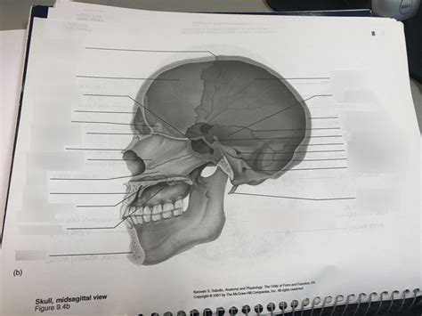 Sinuses Of The Skull Midsagittal Diagram Quizlet