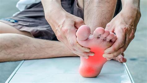 Frotar Lim N En Los Pies El Remedio Natural Para Curar El Pie De