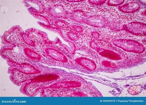 Tissue Of Small Intestine Duodenum Large Intestine Human And Stomach