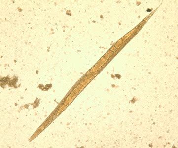 Parasitology Quiz Flashcards Quizlet