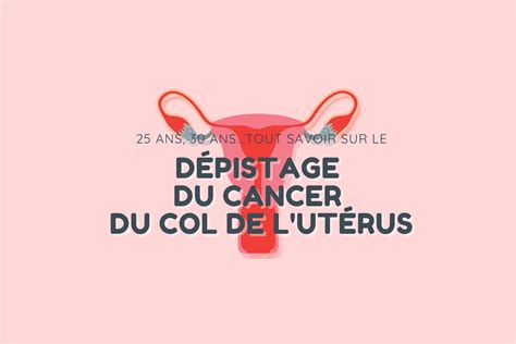 Cancer De Col Uterin