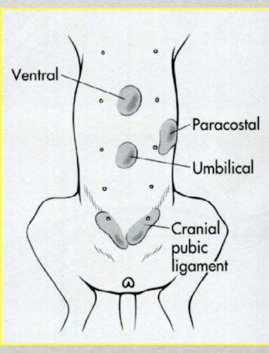 Hernias Flashcards Quizlet