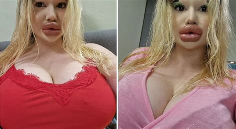 La Donna Con Le Labbra Pi Grandi Al Mondo Vuole Battere Un Nuovo