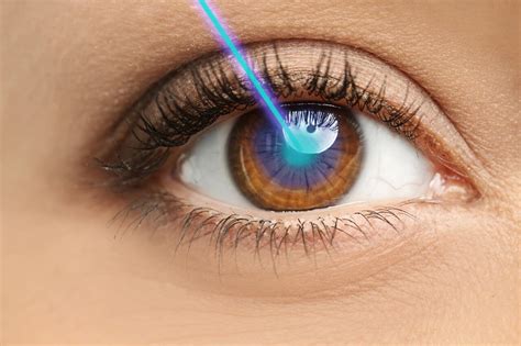 Cirurgia Refrativa Visão Hospital de Olhos