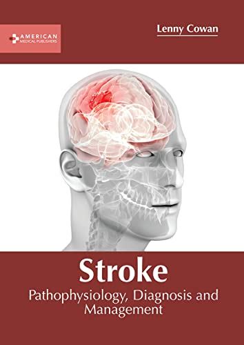 Stroke Pathophysiology Diagnosis And Management 9781639273317