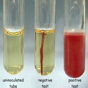 Motility Culture Method Introduction Flagella Fibril Principle