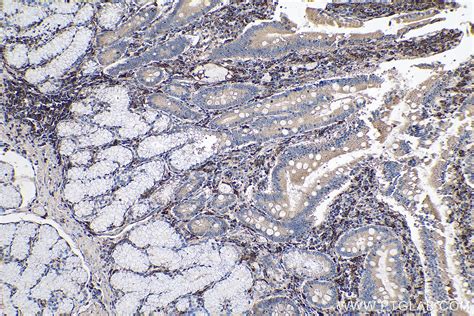 IHCeasy HLA DRB1 Ready To Use IHC Kit KHC0623 Proteintech