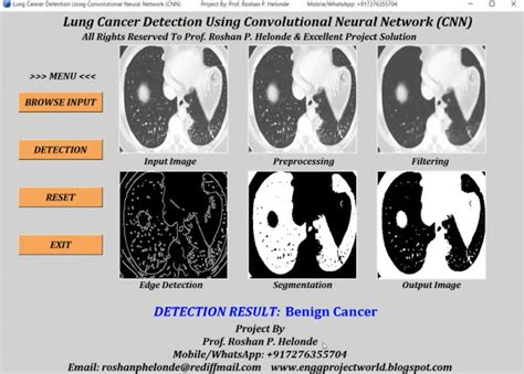 lung cancer detection using convolutional neural network cnn python opencv tensorflow project
