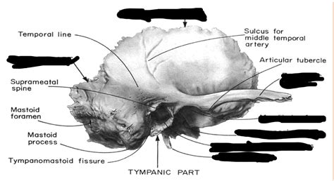 Temporal Bone Diagram Diagram Quizlet