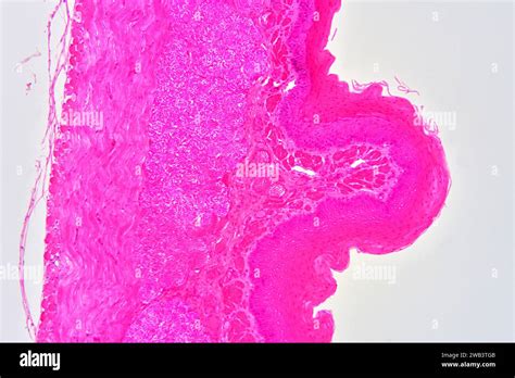 Non Keratinized Stratified Squamous Epithelium Hi Res Stock Photography