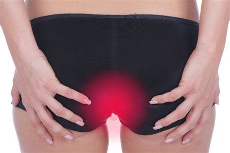 Hämorrhoiden Symptome typischen Anzeichen vergrößerter