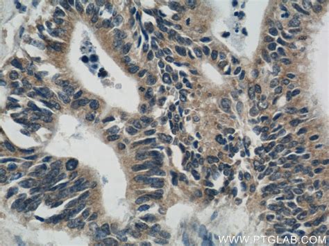 Prdx Antibody Ap Proteintech