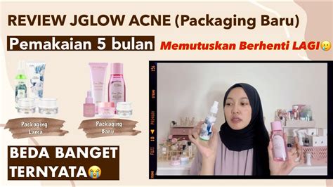 Review Jujur Jglow Skincare Pemakaian Bulan Paket Acne Ultima Youtube
