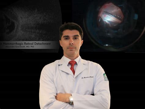 dr alexandre grantinetti retinólogo especialista em retina e catarata