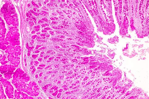 Small Intestine Duodenum And Vermiform Appendix Human Under The