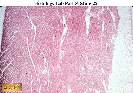 Endocardium Histology