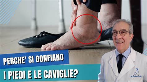 Piedi E Caviglie Gonfie Quali Sono Le Cause E Le Malattie Associate