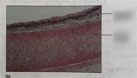 Microscope Trachea Cross Section Diagram Quizlet
