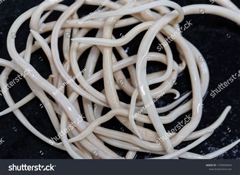 Ascariasis Is A Disease Caused By The Parasitic Roundworm Ascaris