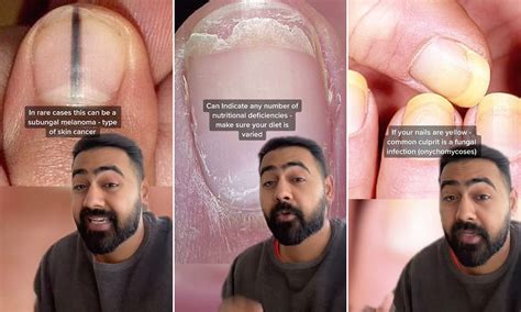 Aggregate More Than 144 Dark Vertical Lines On Nails In Coedo Vn