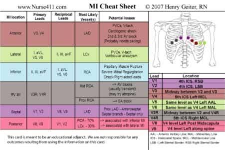 12 Lead Ekg Interpretation Cheat Sheet Cheat Sheet
