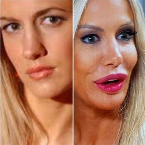 El Impactante Cambio En El Rostro De La Argentina Luciana Salazar Con