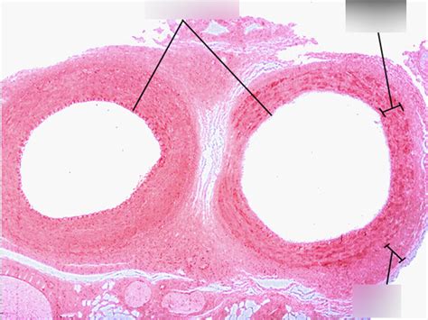Artery Vein Nerve Diagram Quizlet