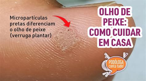OLHO DE PEIXE COMO CUIDAR EM CASA YouTube