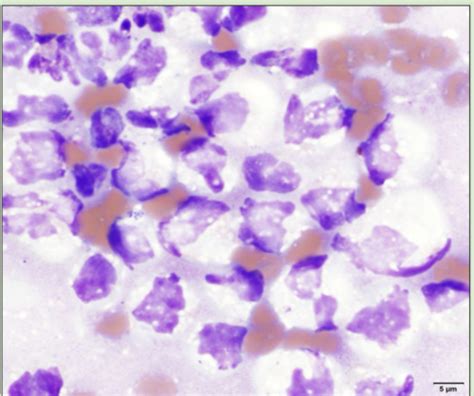 Diagnostic Cytology Flashcards Quizlet