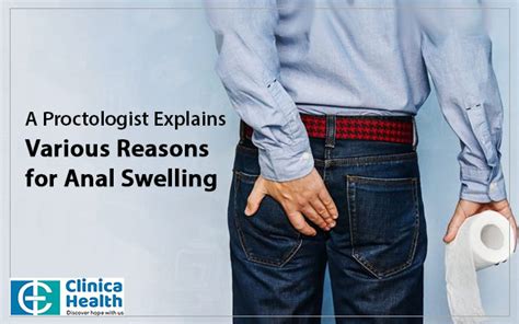 A Proctologist Explains Various Reasons For Anal Swelling