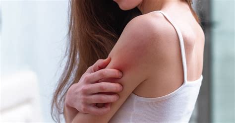 Como prevenir as doenças de pele Clínica Coderm Dr Eduardo Colácio