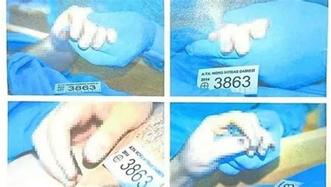 Cem Garipoğlu nun elindeki mor lekelerin sırrı belli oldu