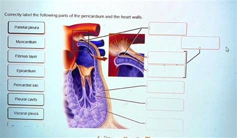 SOLVED Correctly Label The Following Parts Of The Pericardium And The