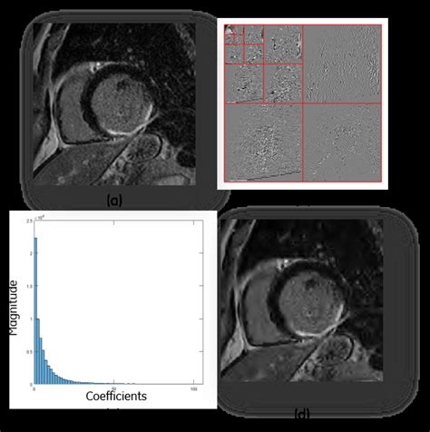 3 wavelet sparsity in cardiac mri a original noisy image b its download scientific