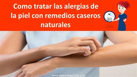 Como Tratar Las Alergias De La Piel Con Remedios Caseros Naturales