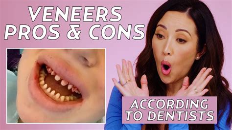 The Cost Of Dental Veneers Cosmetic Dentists Share Pros Cons