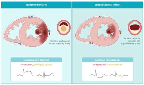 Cardiovascular Part Flashcards Easy Notecards