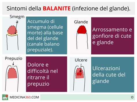 Partes Del Glande